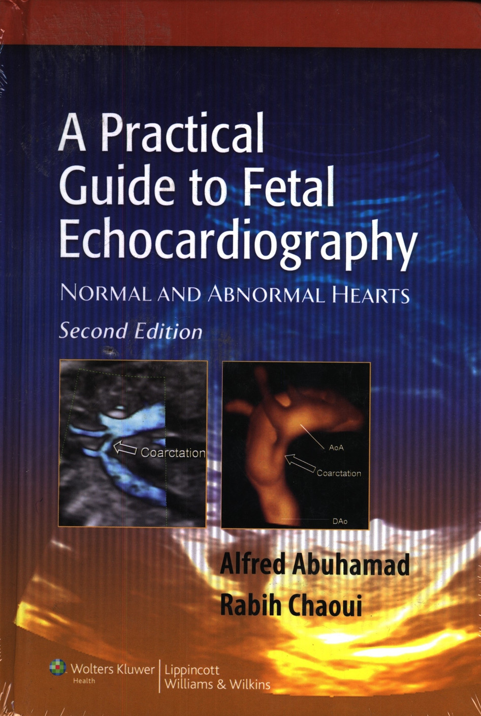 A Practical Guide to Fetal Echocardiography 2nd Revised edition Edition - Buy A Practical Guide ...
