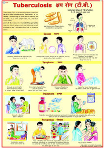 Tuberculosis Prevention Posters