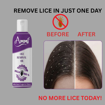 Ammi Herbal Lice Oil 100g | Controls Lice & Nits | Safe for Family Use ...