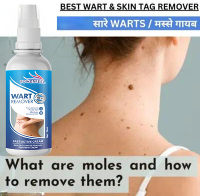 POWERFEEL Wart Remover Cream - Remove Warts and Tags Painlessly, Rapid ...