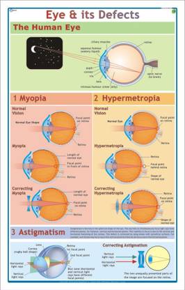 Eyes : Defects & Remedies Chart Paper Print - Educational posters in ...
