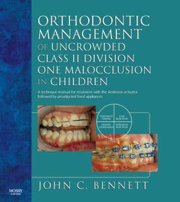 Orthodontic Management of Uncrowded Class II Division One Malocclusion ...