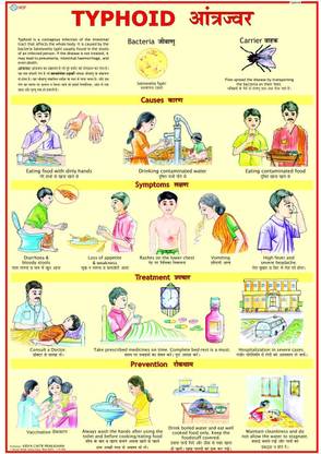 Typhoid Chart Photographic Paper - Educational posters in India - Buy ...