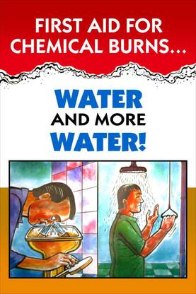 madhusigns MADHU - First aid for chemical burns poster in self adhesive ...