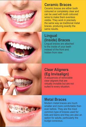 Poster Dental Dentist Doctor Ceramic Braces Lingual Braces Clear ...