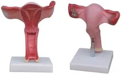 SIMNIS Human Female Realistic Uterus Model, Anatomical Model, Fiber ...