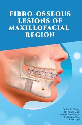 FIBRO-OSSEOUS LESIONS OF MAXILLOFACIAL REGION: Buy FIBRO-OSSEOUS ...