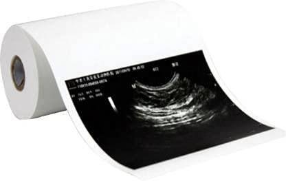 REVALS Ultrasound Thermal Printer Paper Rolls 110S 110mm*20 meter-Set ...