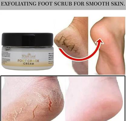White Leaf Foot Crack Cream For Dry Cracked Heels & Feet 100% ...