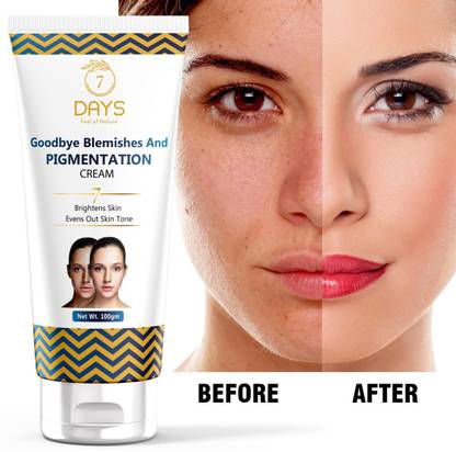 7 Days Pigmentation cream For Dark body parts neck ankles knuckles ...