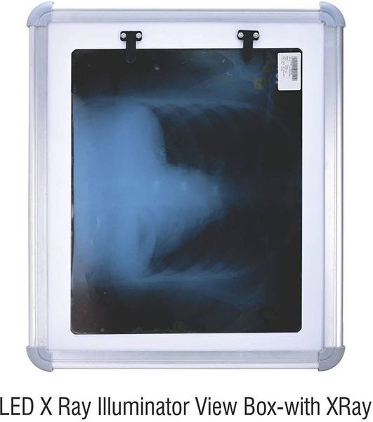 Thermocare LED BOX X-Ray Viewer - Price History
