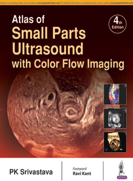 Atlas of Small Parts Ultrasound - Ultrasound with Color Flow Imaging ...