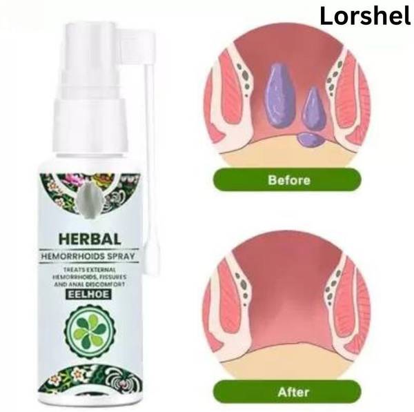 LORSHEL hemorrhoids spray piles herbal piles hemorrhoids reliefspray ...