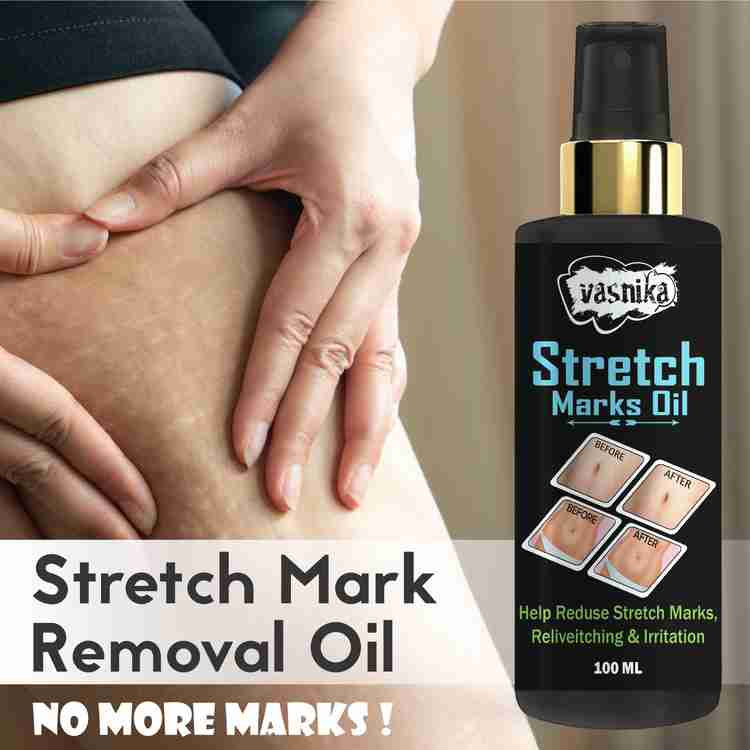 VASNIKA Stretch Marks Oil to Minimize Stretch Marks & Even Out Skin ...