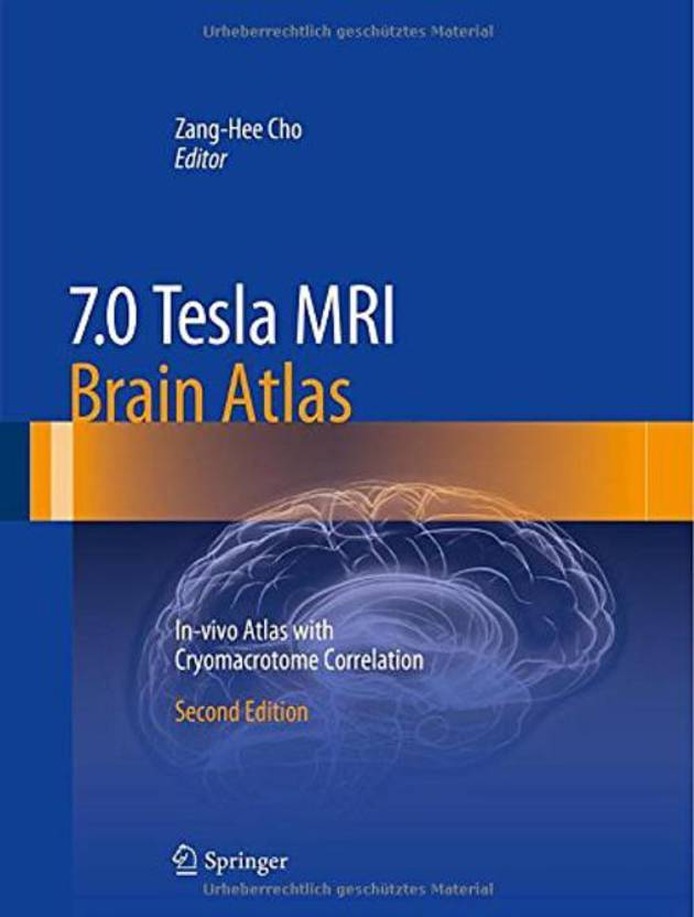 7.0 Tesla MRI Brain Atlas: Buy 7.0 Tesla MRI Brain Atlas by unknown at ...