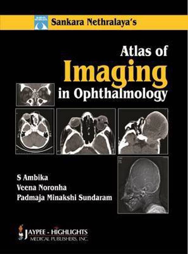 Atlas of Imaging in Ophthalmology: Buy Atlas of Imaging in ...