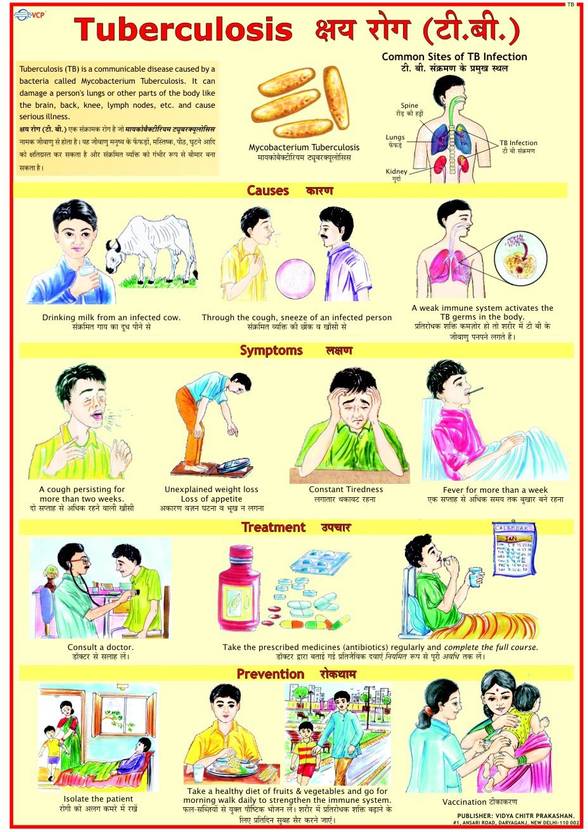Tuberculosis Chart (TB) Photographic Paper - Educational posters in ...