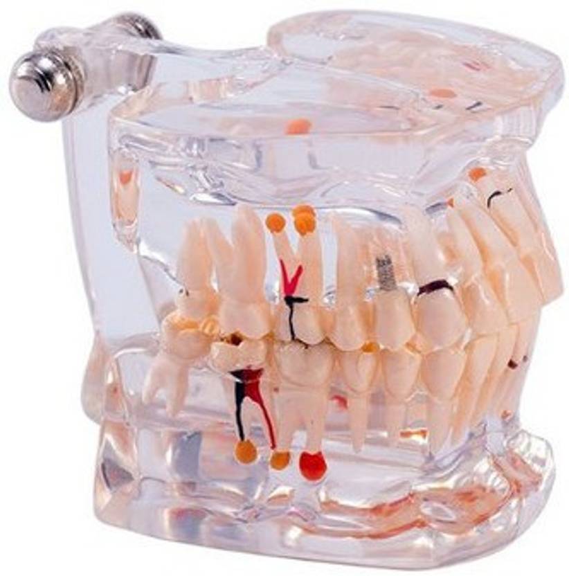 RREN Standard Tooth Teaching Giant Dentist Teeth Model#8 Anatomical ...