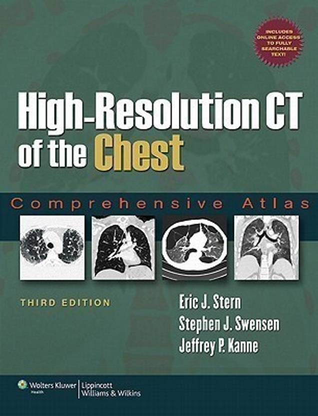 High-Resolution CT of the Chest: Buy High-Resolution CT of the Chest by ... High-Resolution CT of the Chest: Buy High-Resolution CT of the Chest by ...
