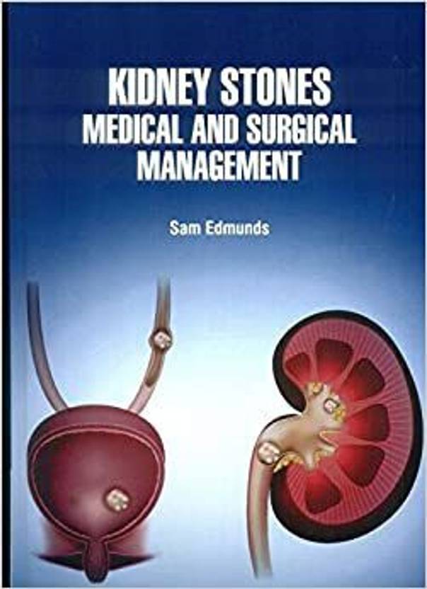 KIDNEY STONES MEDICAL AND SURGICAL MANAGEMENT (HB 2021): Buy KIDNEY ...