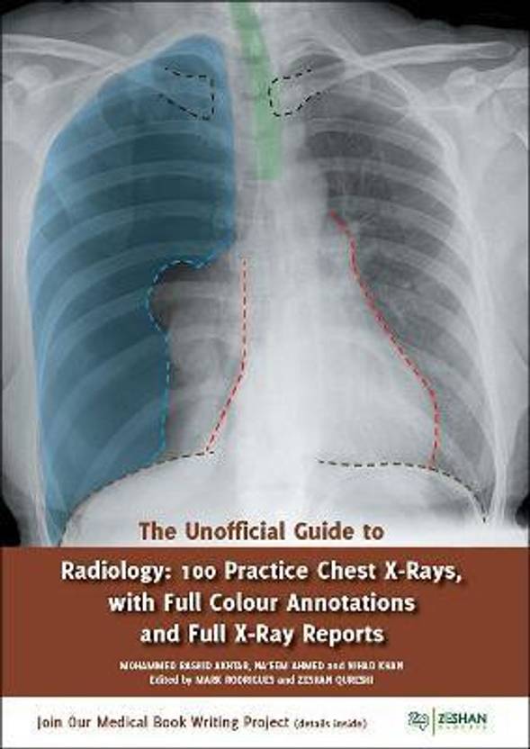 The Unofficial Guide to Radiology: 100 Practice Chest X Rays with Full ...
