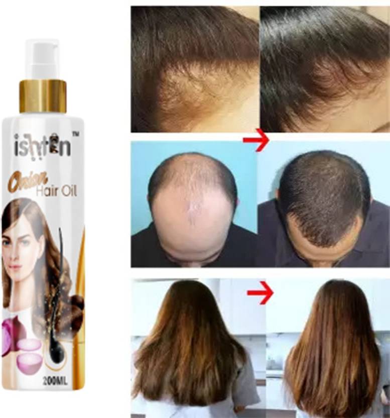 ishton Black Seed Onion Hair Oil - WITH COMB APPLICATOR - Controls Hair ...