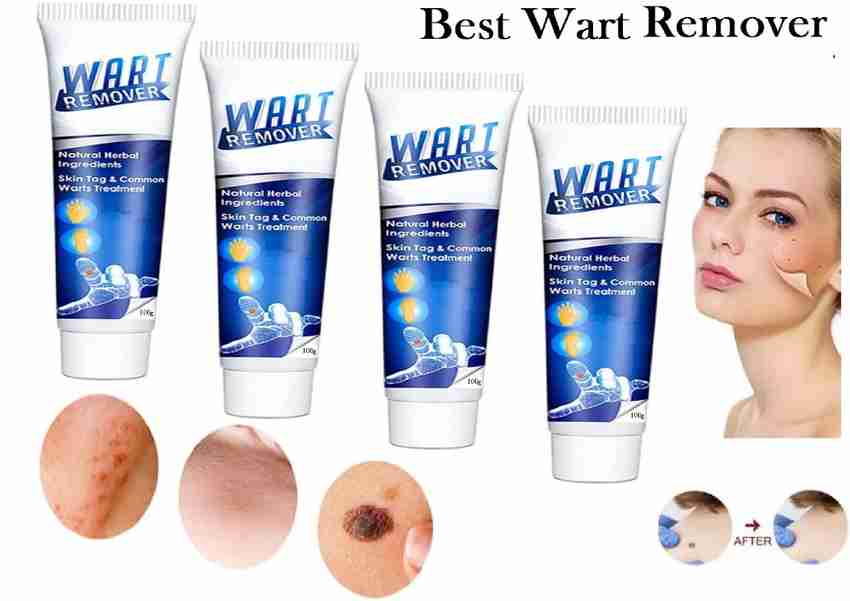 Best Wart Remover
